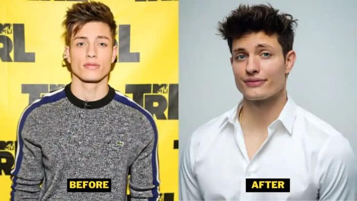 Matt Rife and the Plastic Surgery Buzz: Identifying Fact from Fiction ...